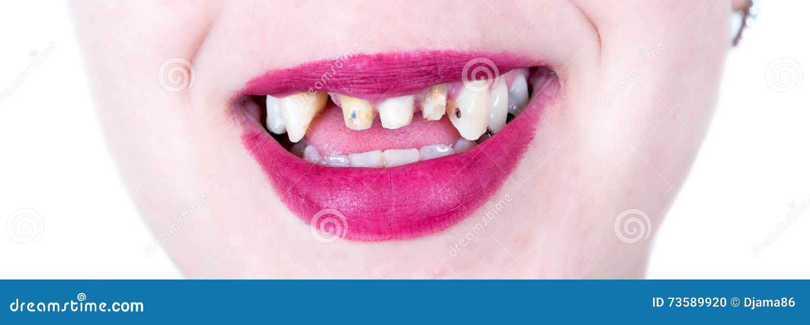 Female smile with no teeth stock photo. Image of girl - 73589920