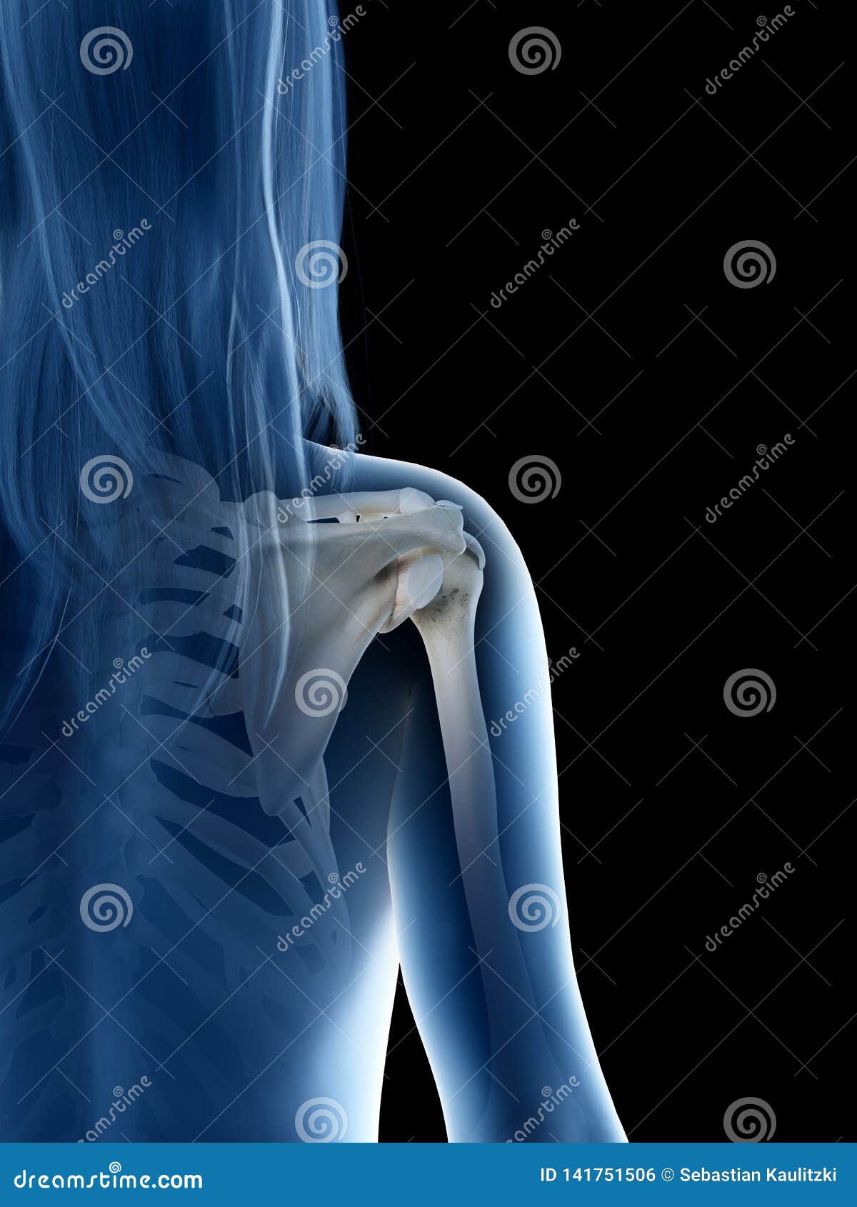 A females shoulder joint stock illustration. Illustration of process ...