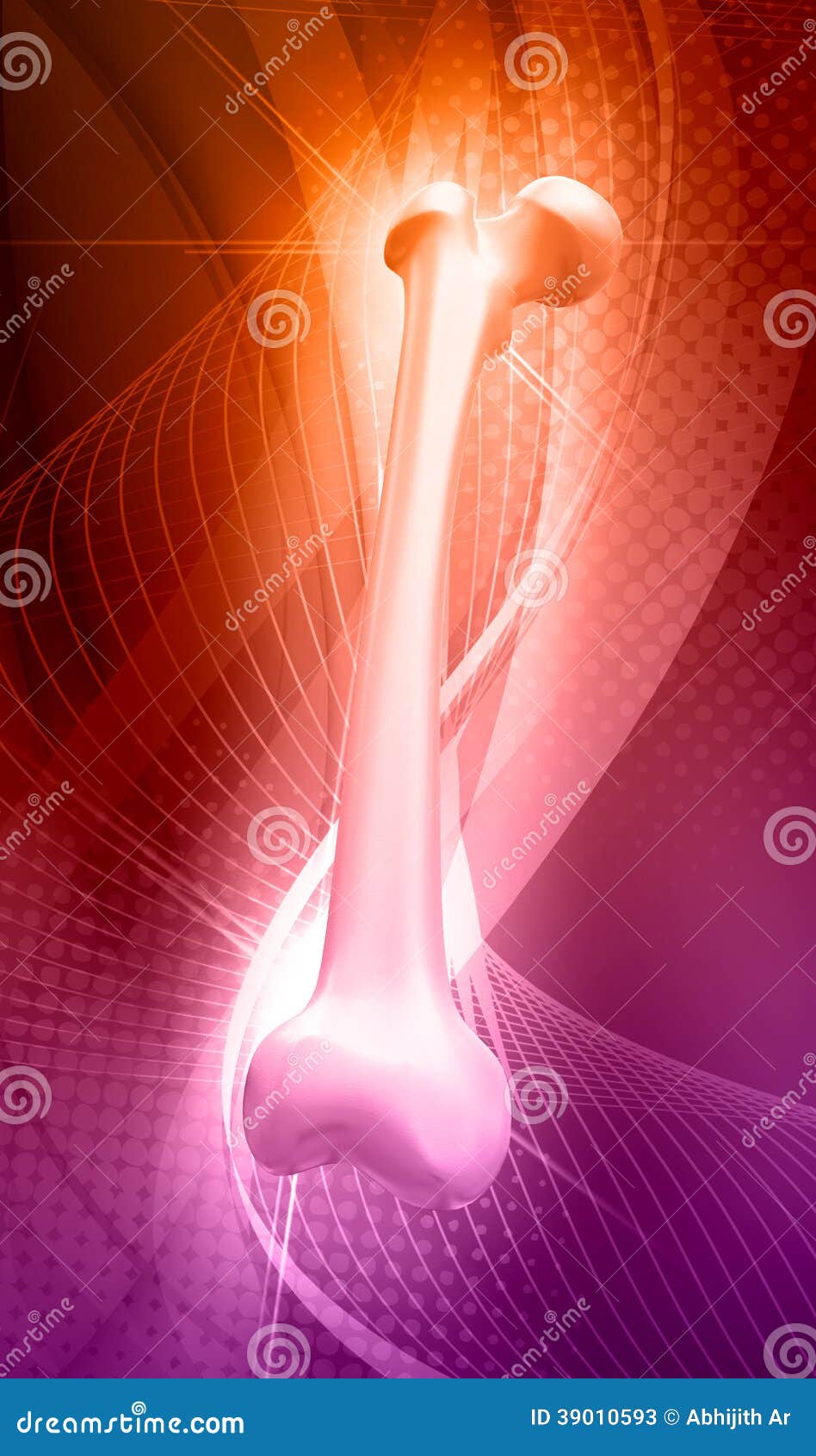 Femur Bone Cut In Half Showing Normal Bone Density And Osteoporosis ...