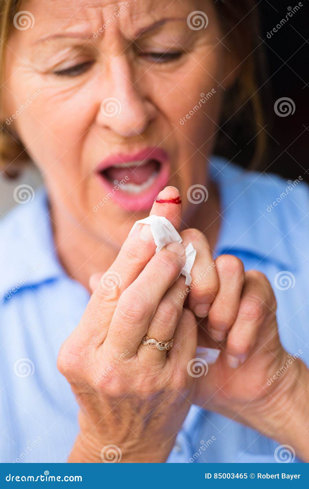 Ferida Ensanguentado Dolorosa Do Dedo Do Corte Da Mulher Imagem de ...