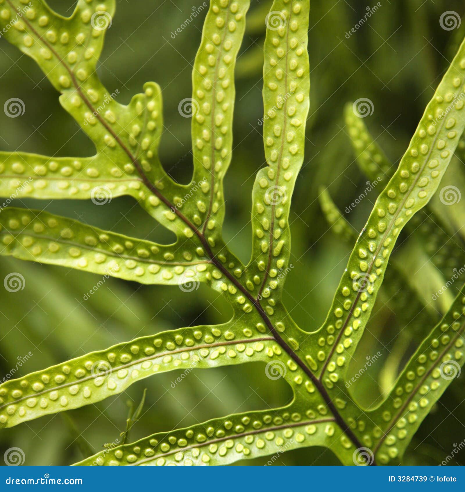 Fern Sorus Cross Section. Incision Through The Fern Sorus Under A ...