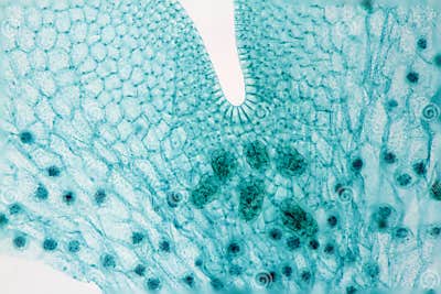 Fern Prothallium - Reproductive Organs Stock Photo - Image of ...