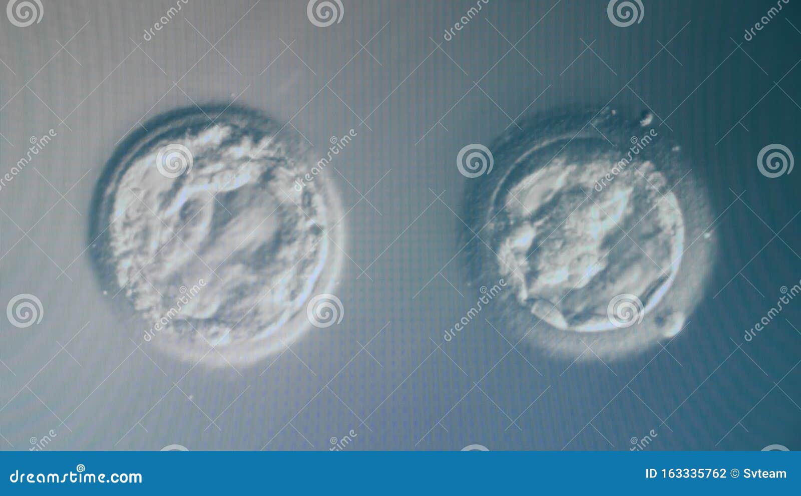 Fertilized Egg Cells are Being Analyzed Under a Microscope Stock ...