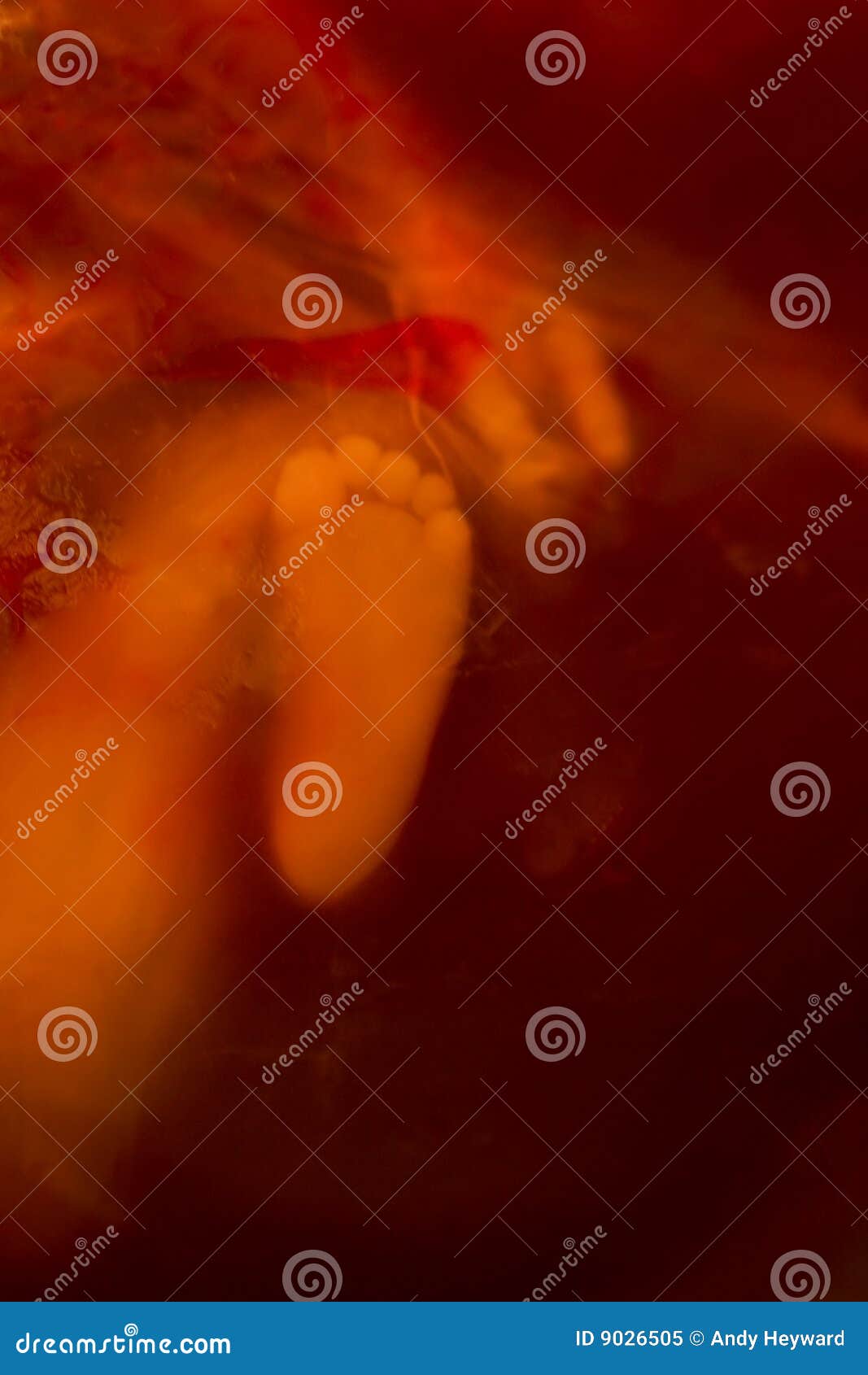 Feto mortinato 02 imagen de archivo. Imagen de pena, bebé - 9026505