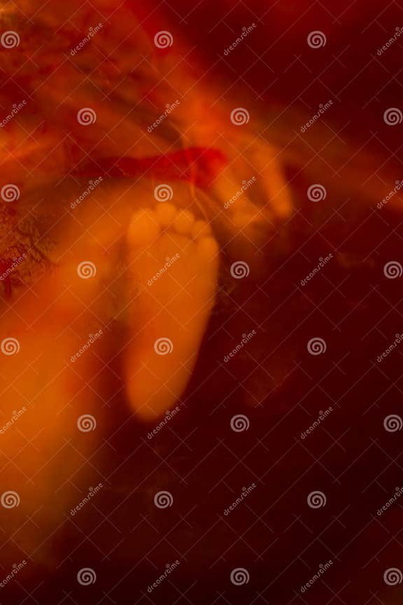 Feto mortinato 02 imagen de archivo. Imagen de pena, bebé - 9026505