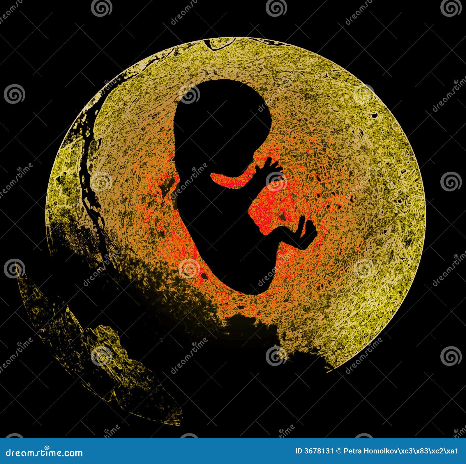 Gravidity Cartoons, Illustrations & Vector Stock Images - 57 Pictures ...