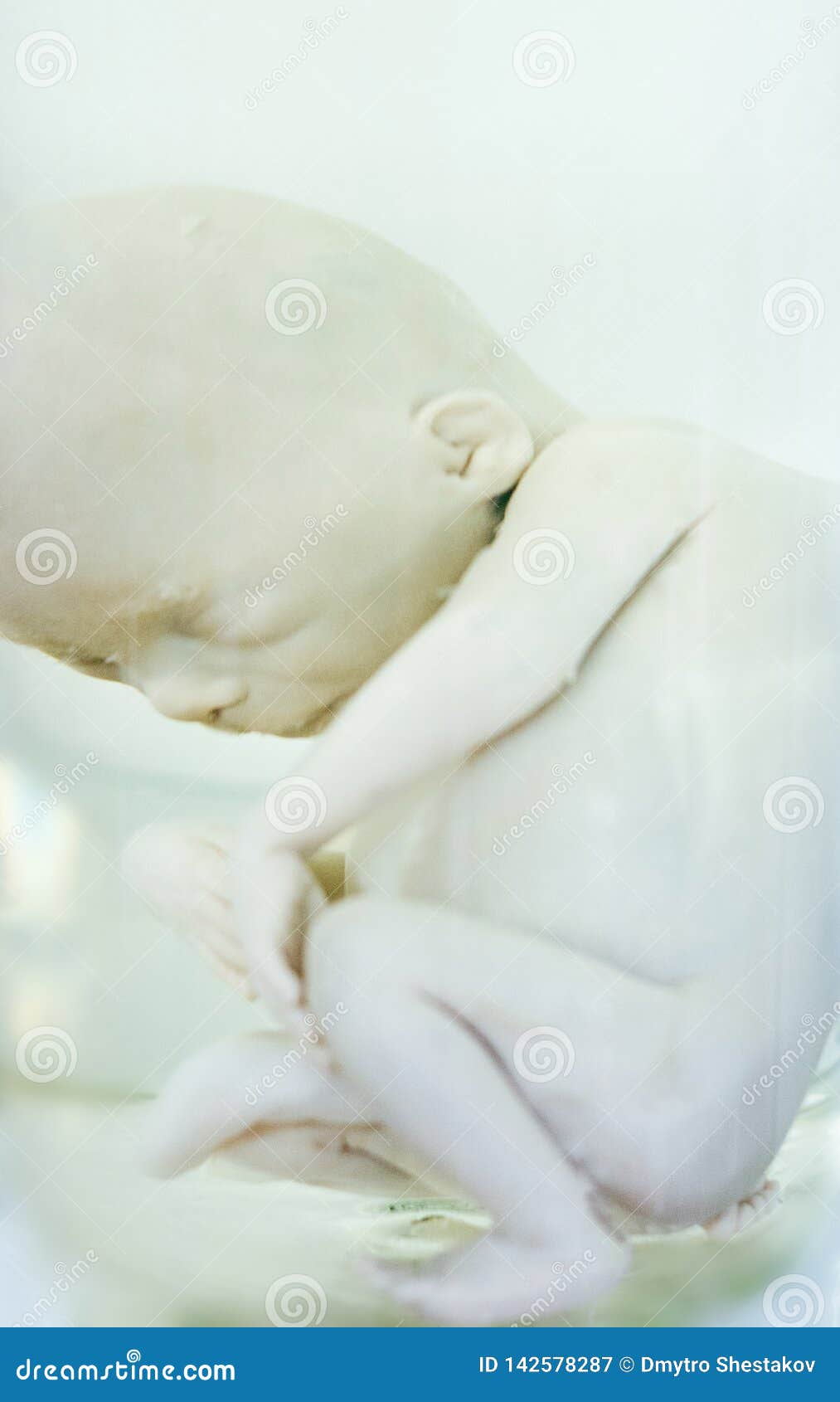Fetus in formalin solution stock image. Image of placenta - 142578287
