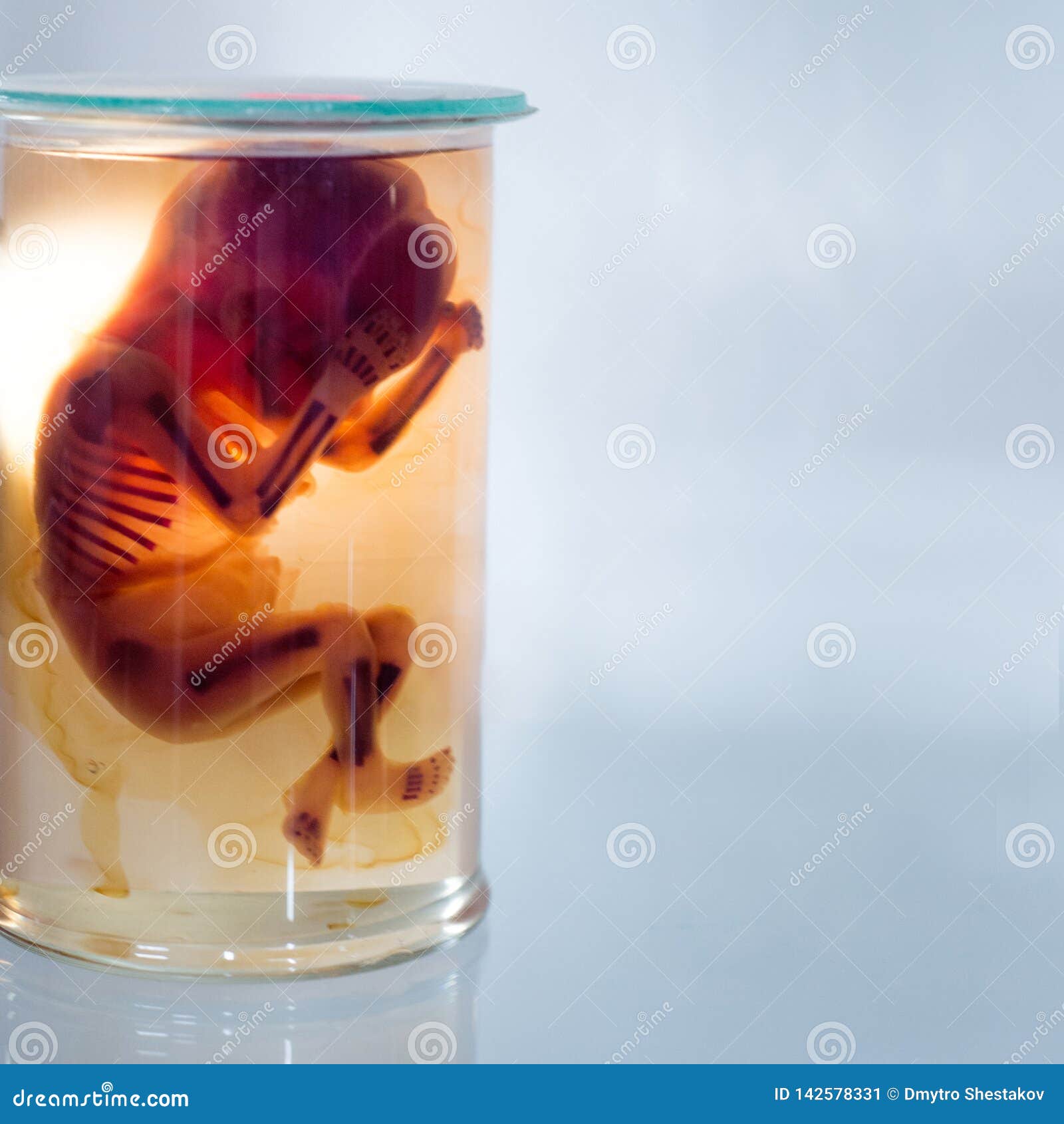 Fetus in formalin solution stock image. Image of blood - 142578331