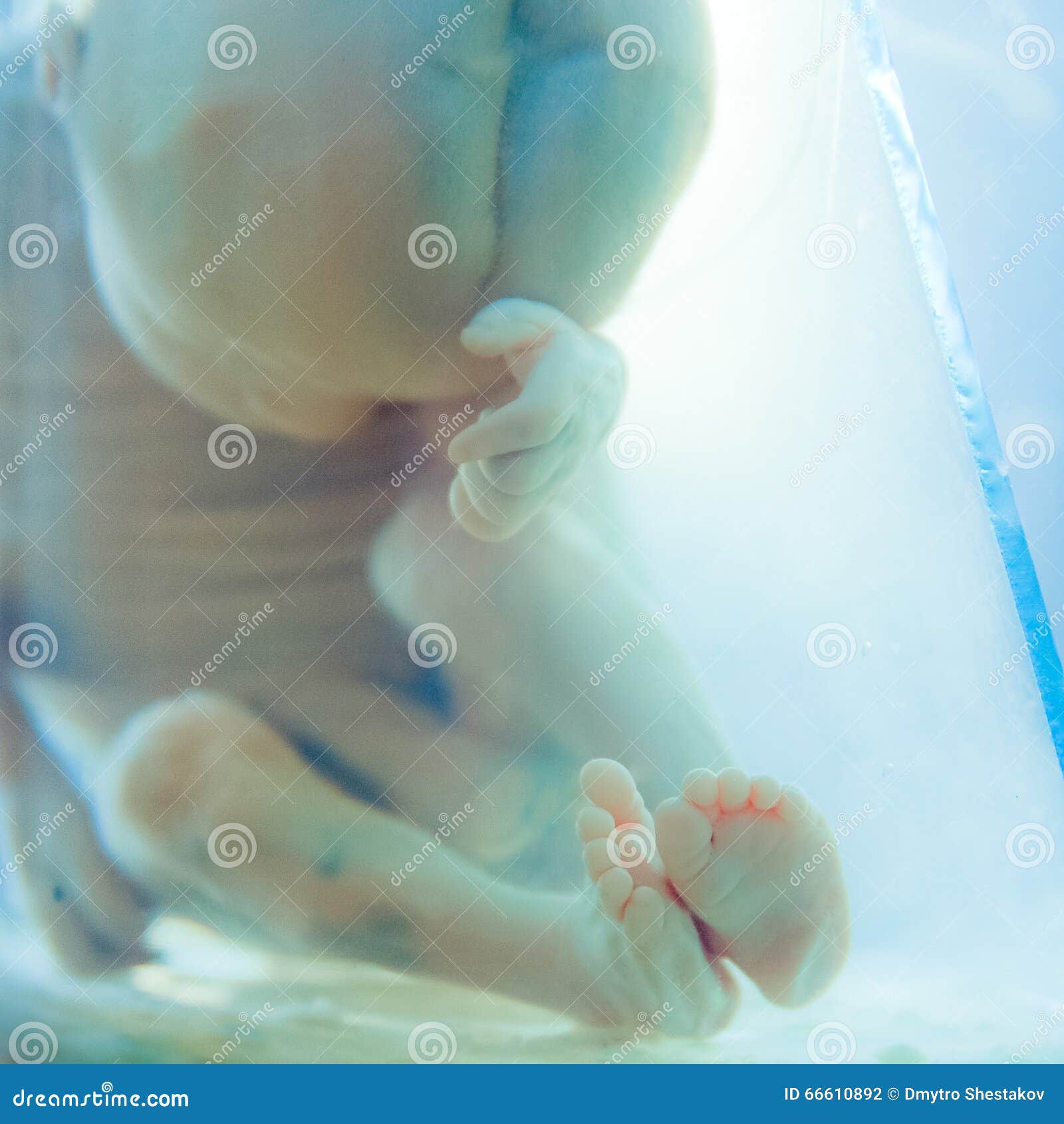 Fetus in formalin solution stock photo. Image of person - 66610892