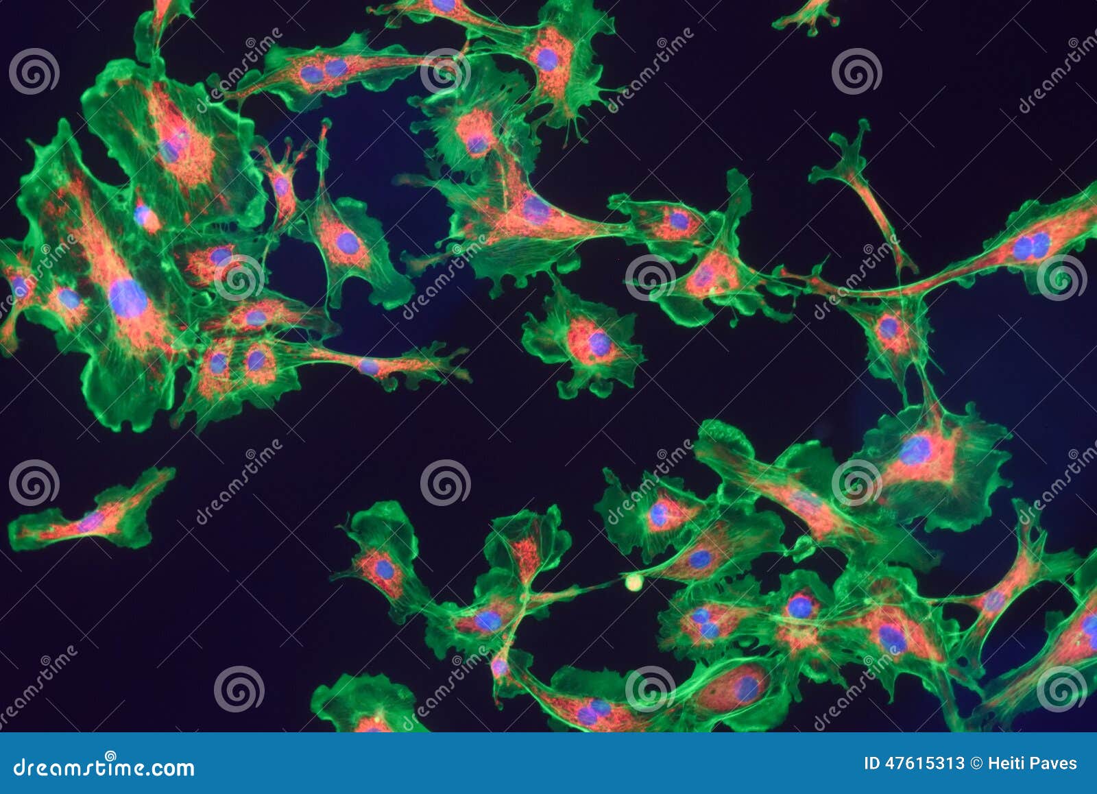 Fibroblast cells stock image. Image of laboratory, microscopy - 47615313