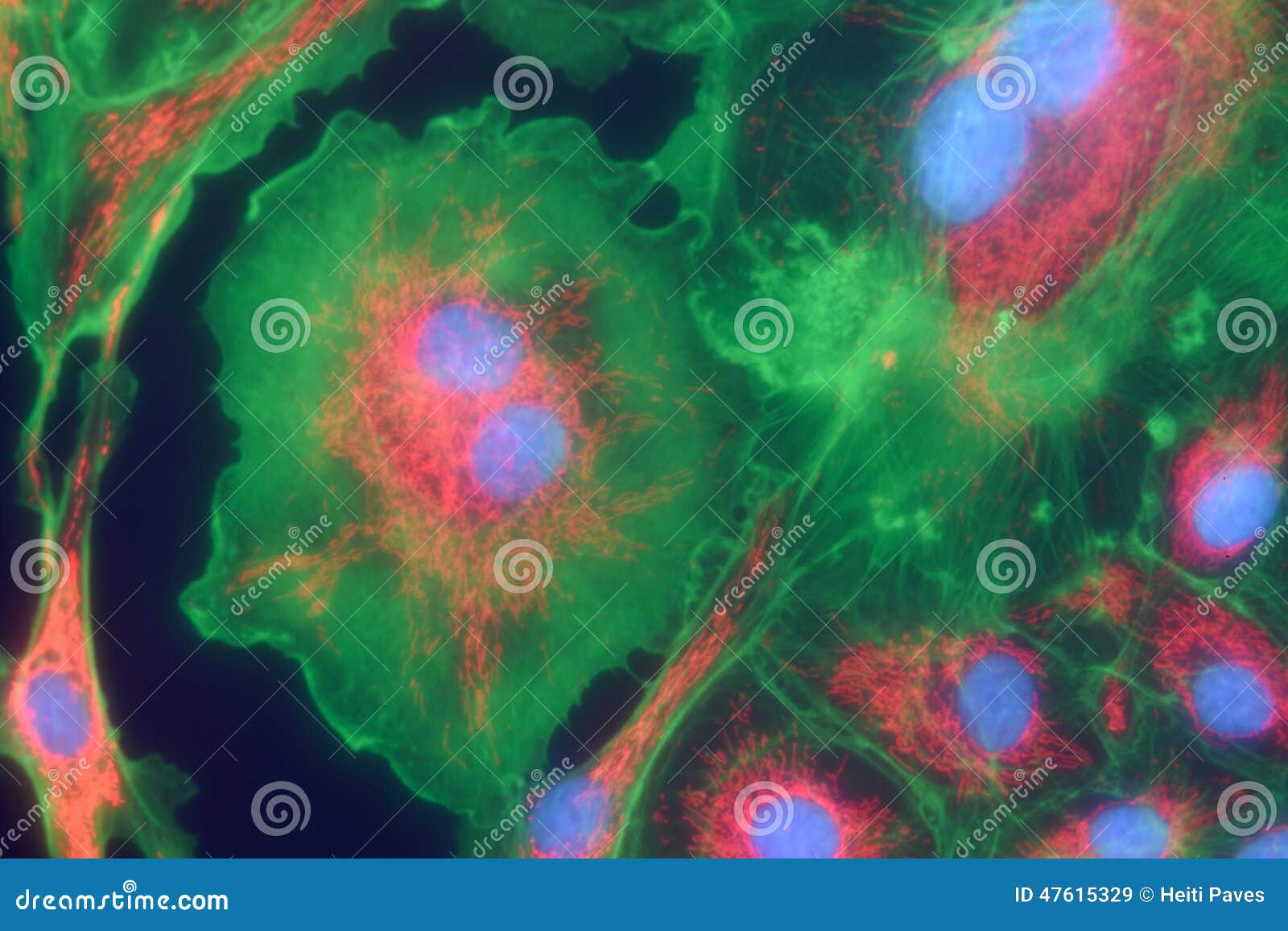 Fibroblast Cells Mpressionistic Stock Image - Image of microfilament ...