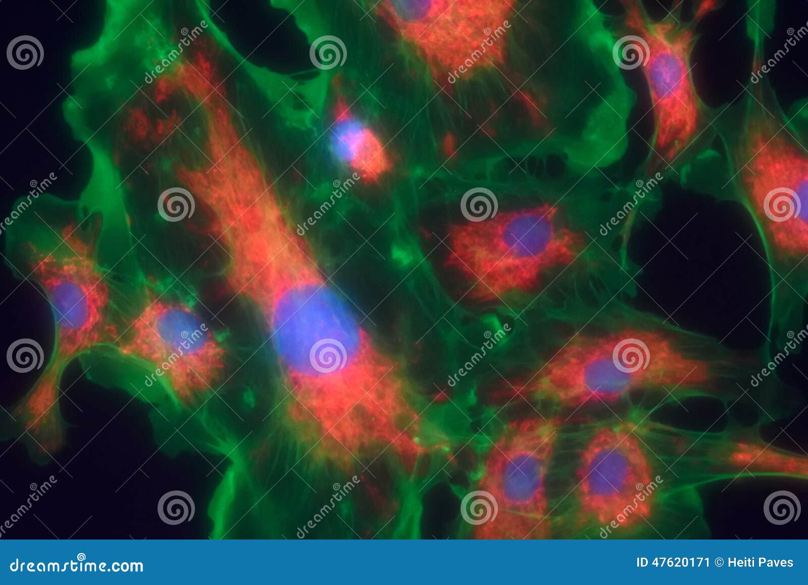 Fibroblast Cells Mpressionistic Stock Image - Image of science, cell ...