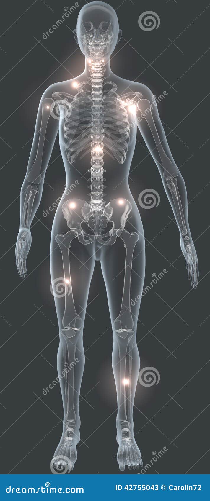 Fibromyalgia syndrome stock illustration. Illustration of transparent ...