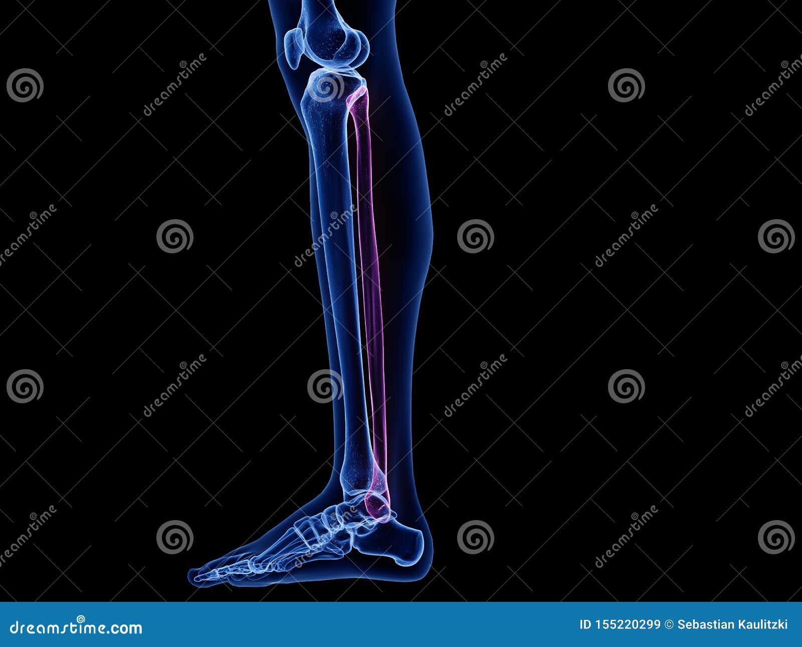 Fibula Bone X-ray Front Or Anterior View. Osteology Of The Human ...