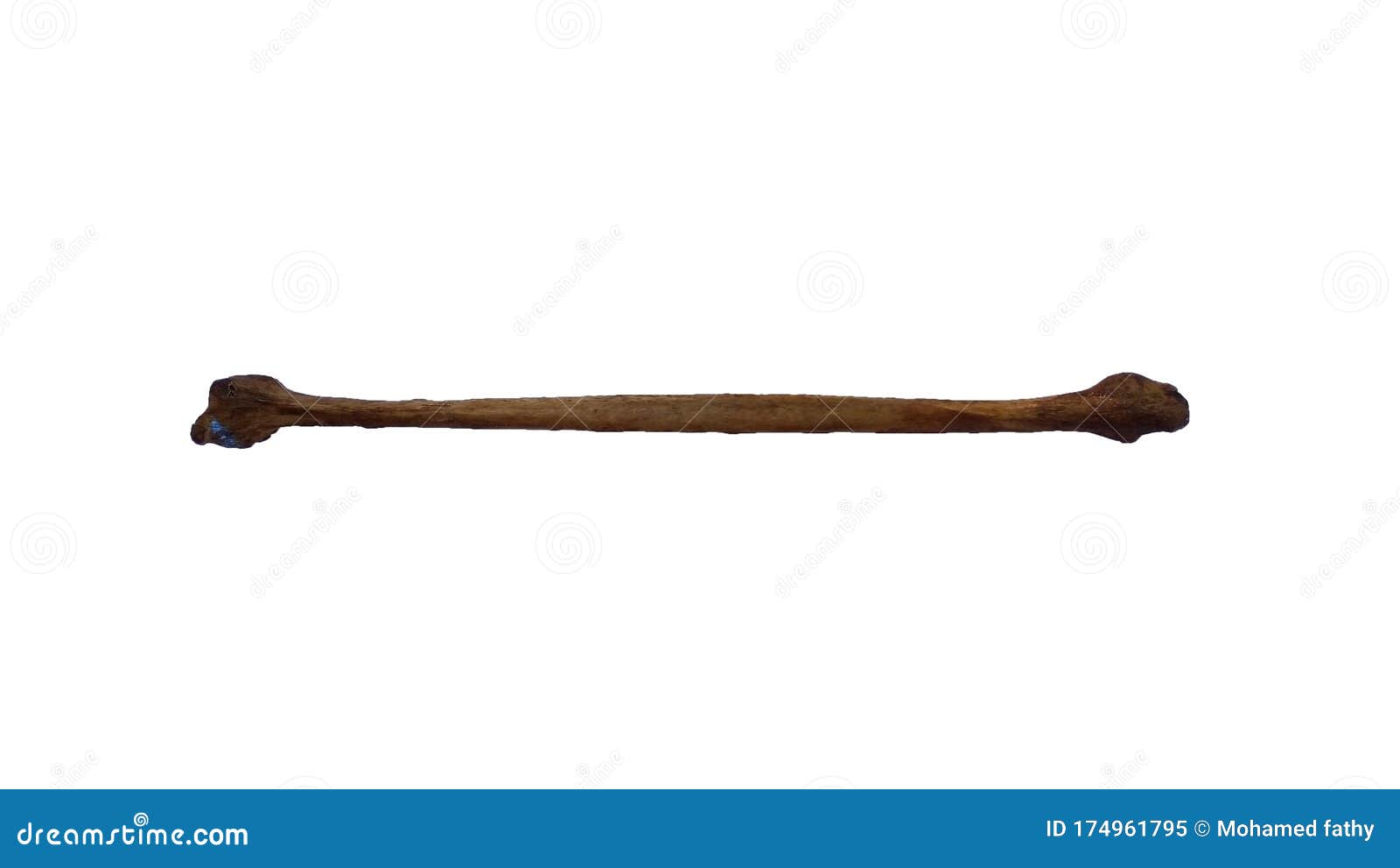 Fibula Bone Of Human On Isolated White Background, Real Bone Stock ...