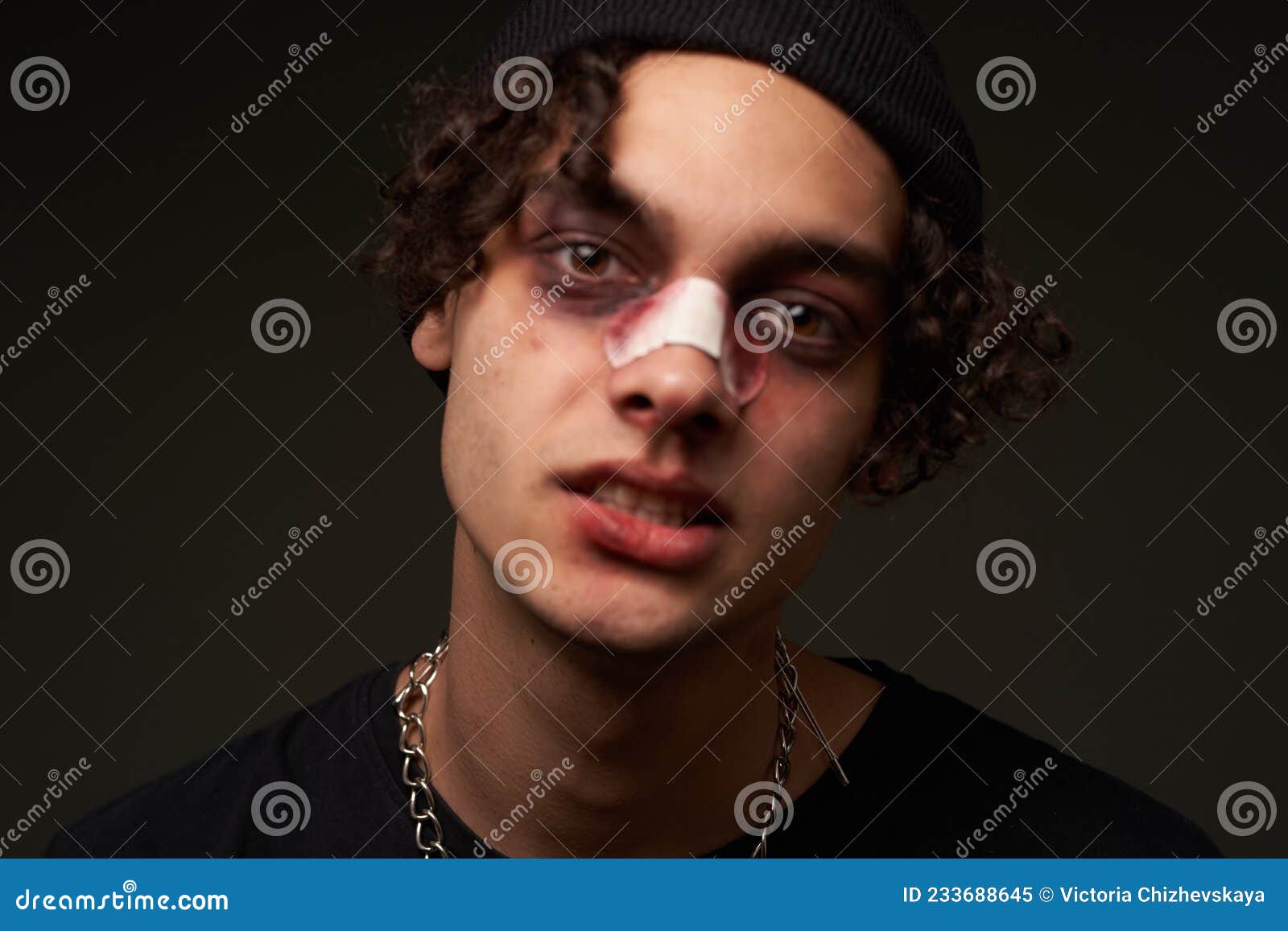 Fighter with Broken Nose Training Boxing Conflict Aggression Injury ...