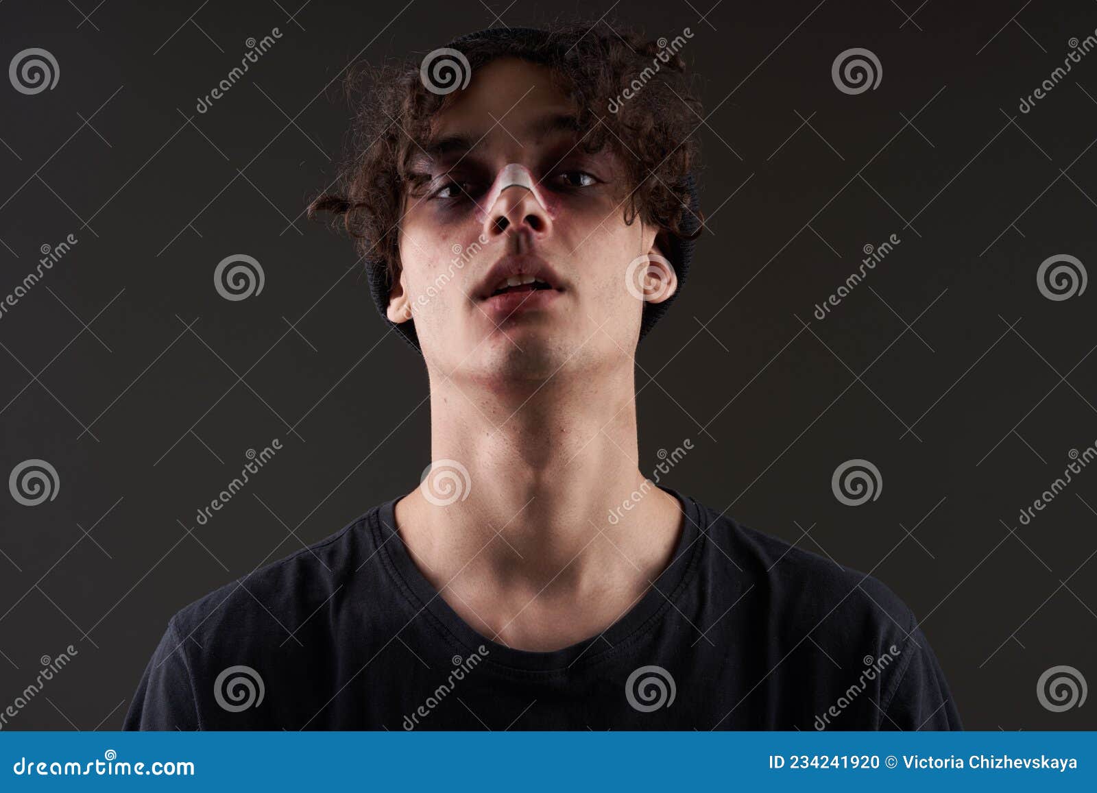 Fighter with Broken Nose Training Boxing Conflict Aggression Injury ...