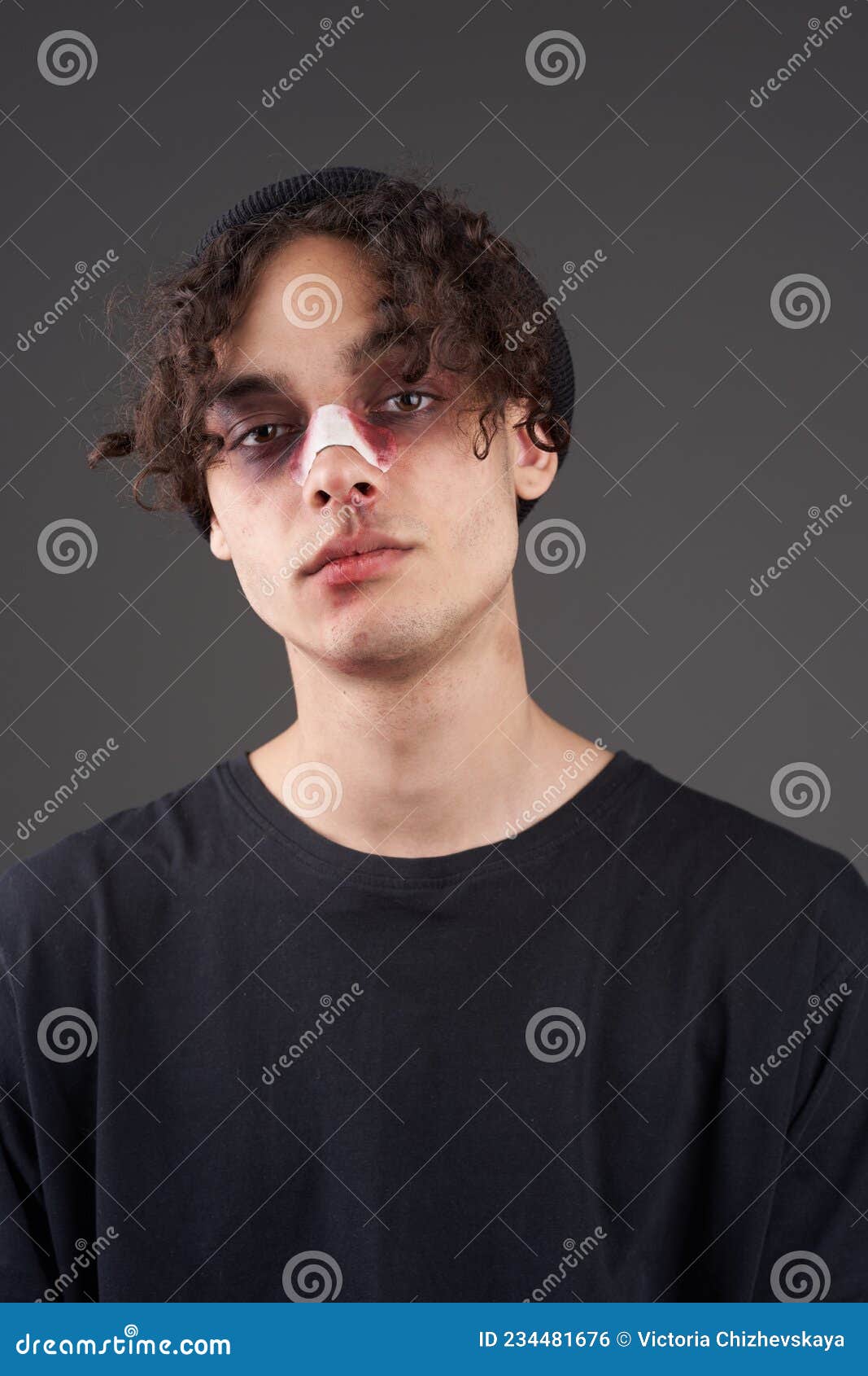 Fighter with Broken Nose Training Boxing Conflict Aggression Injury ...