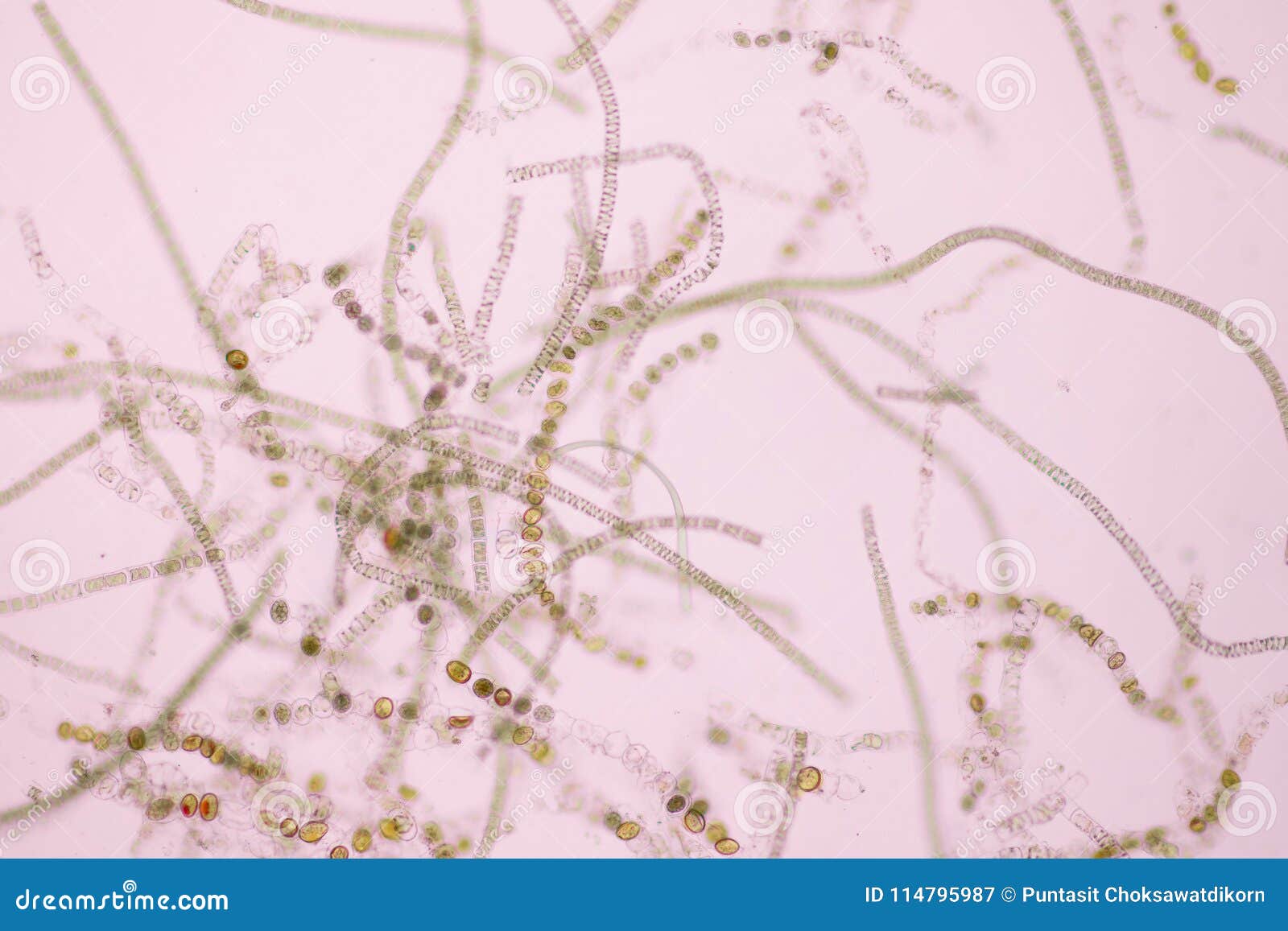Filamentous Algae are Single Algae Cells that Form Long Visible Stock ...