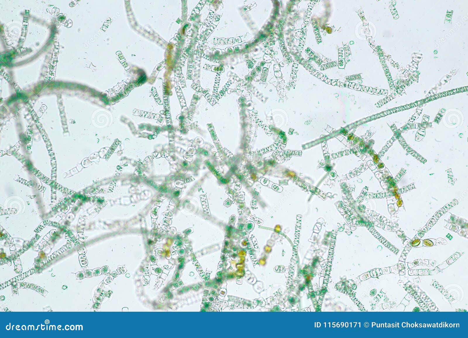 Filamentous Algae are Single Algae Cells that Form Long Visible Stock ...