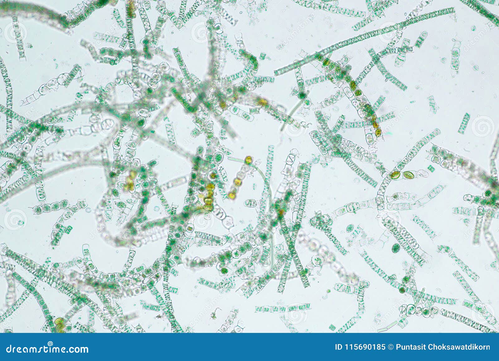 Filamentous Algae are Single Algae Cells that Form Long Visible Stock ...