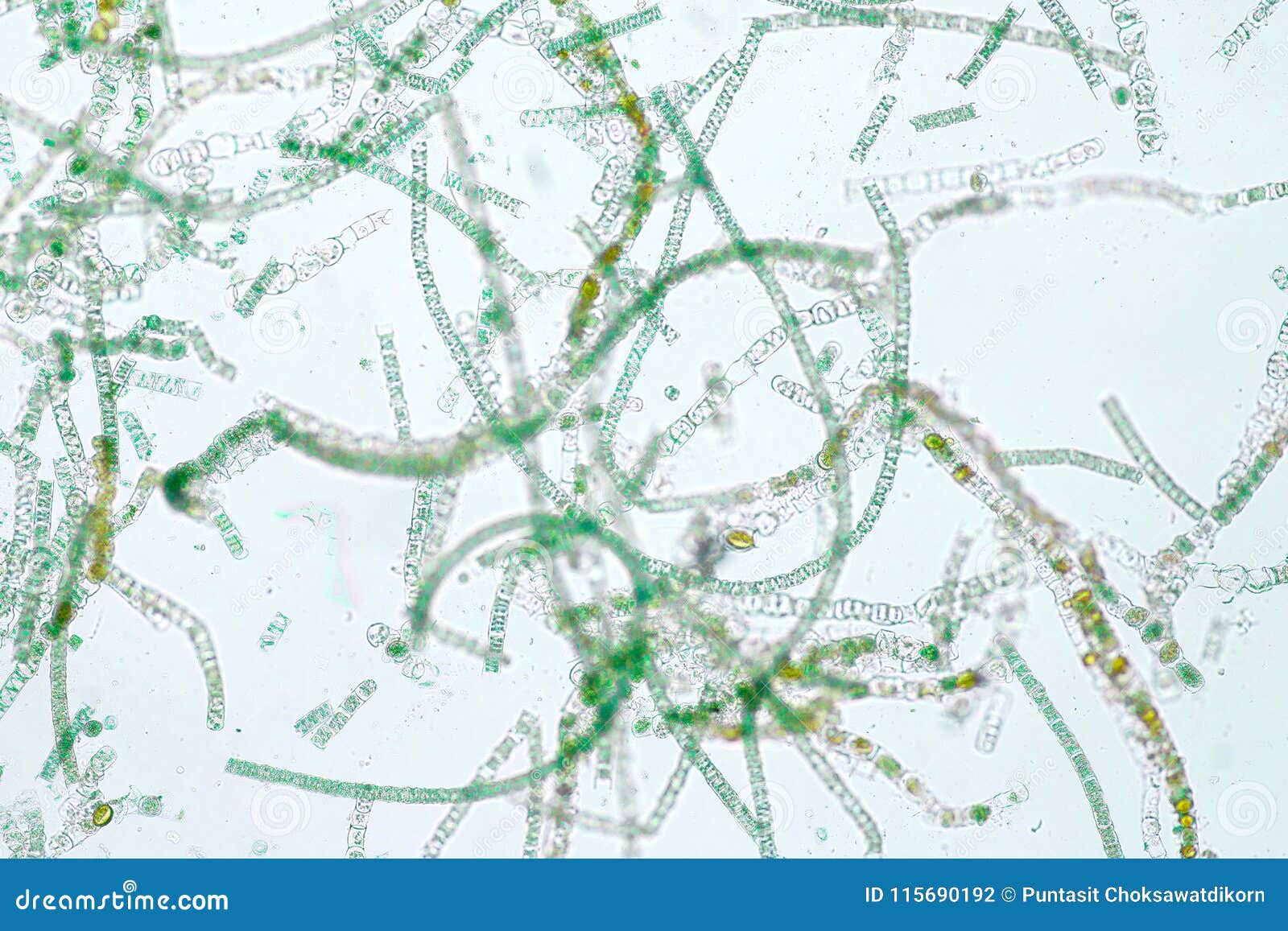 Filamentous Algae are Single Algae Cells that Form Long Visible Stock ...