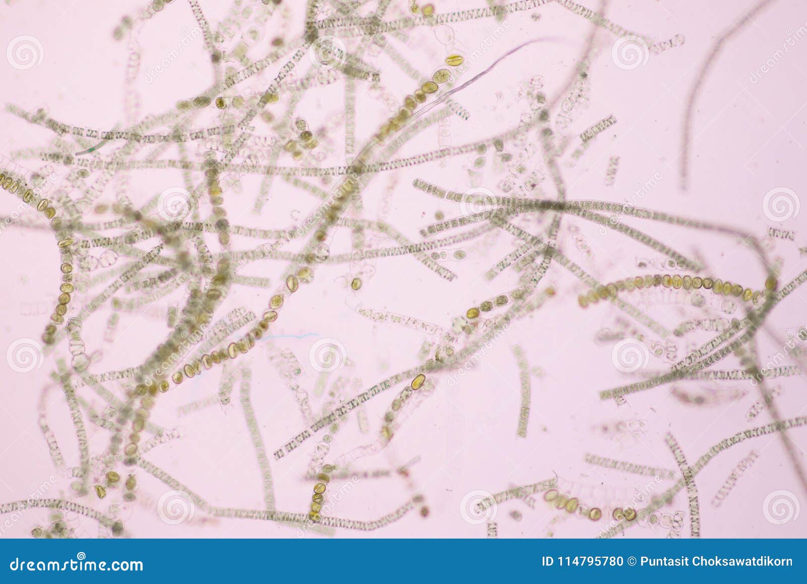 Filamentous Algae are Single Algae Cells that Form Long Visible Stock ...