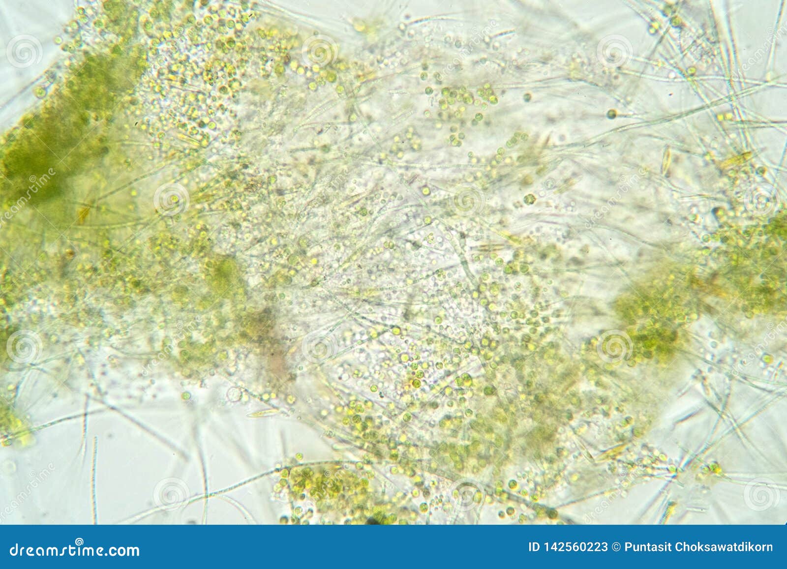 Filamentous Algae are Single Algae Cells that Form Long Visible Chains ...