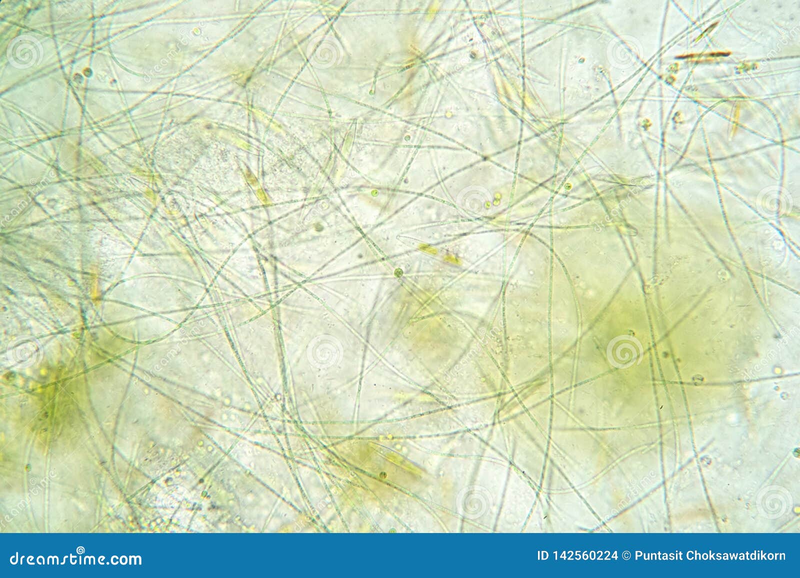 Filamentous Algae are Single Algae Cells that Form Long Visible Chains ...