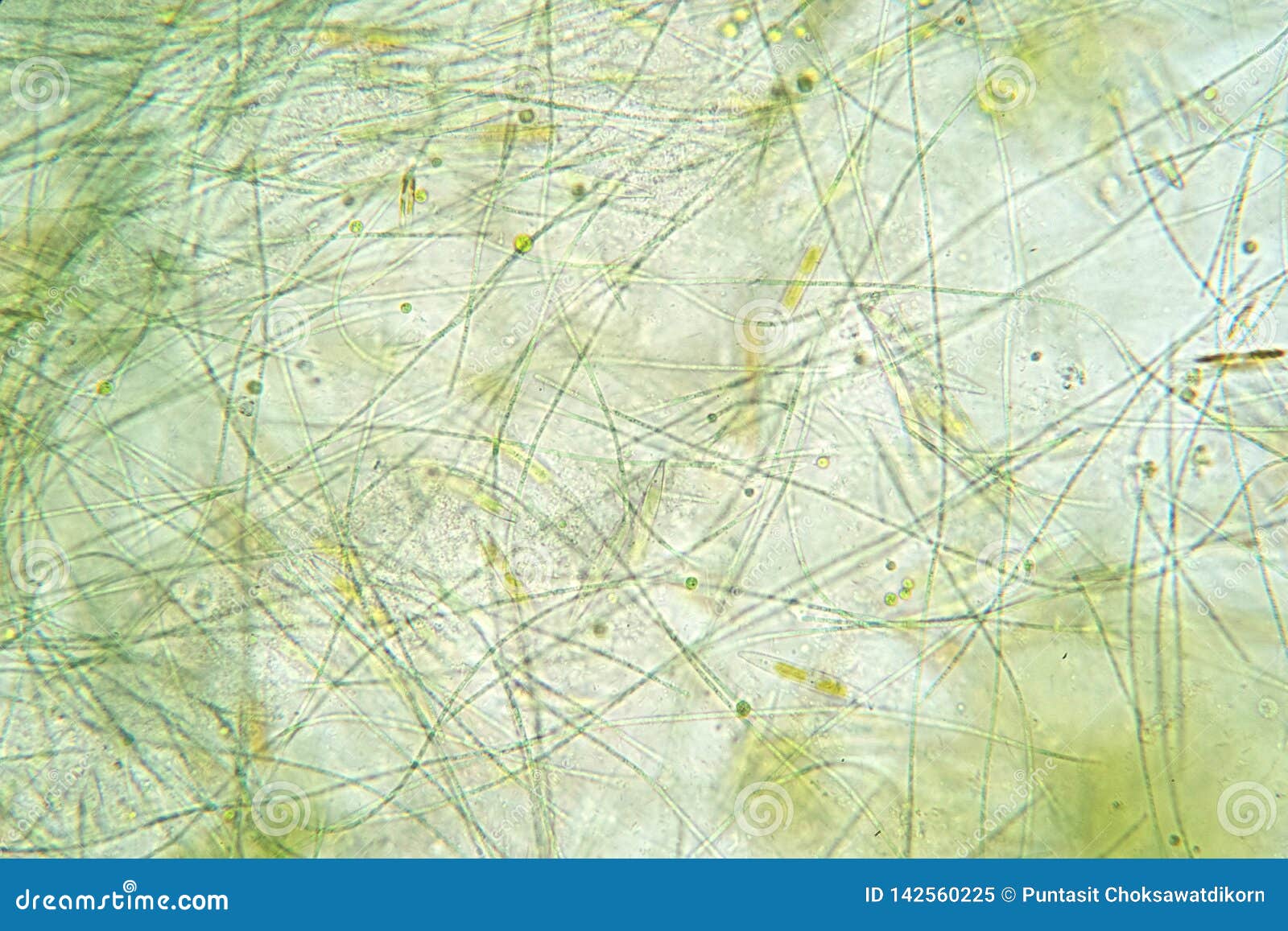 Filamentous Algae are Single Algae Cells that Form Long Visible Chains ...