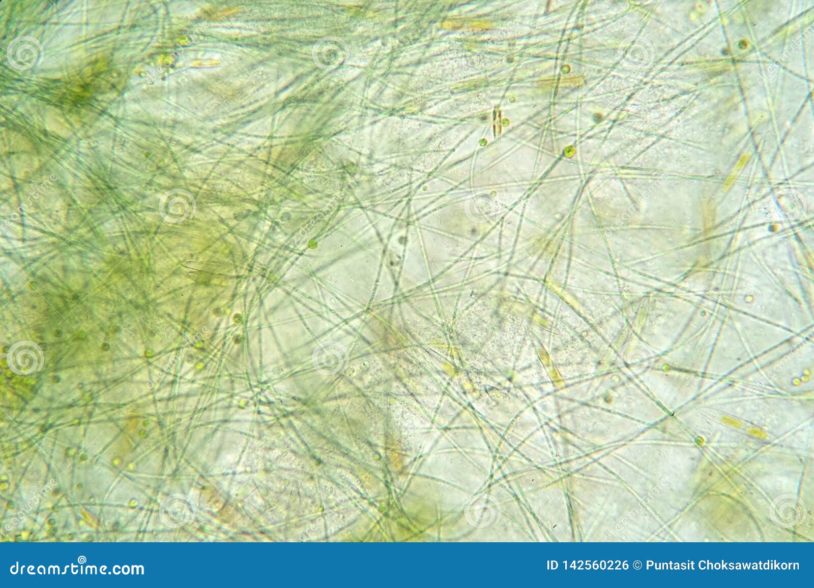 Filamentous Algae are Single Algae Cells that Form Long Visible Chains ...