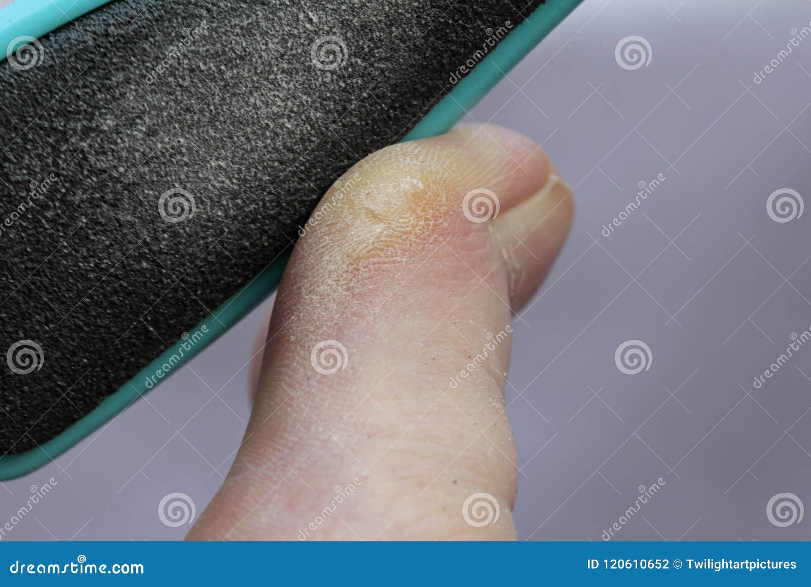 With the file on the toe stock photo. Image of skin - 120610652