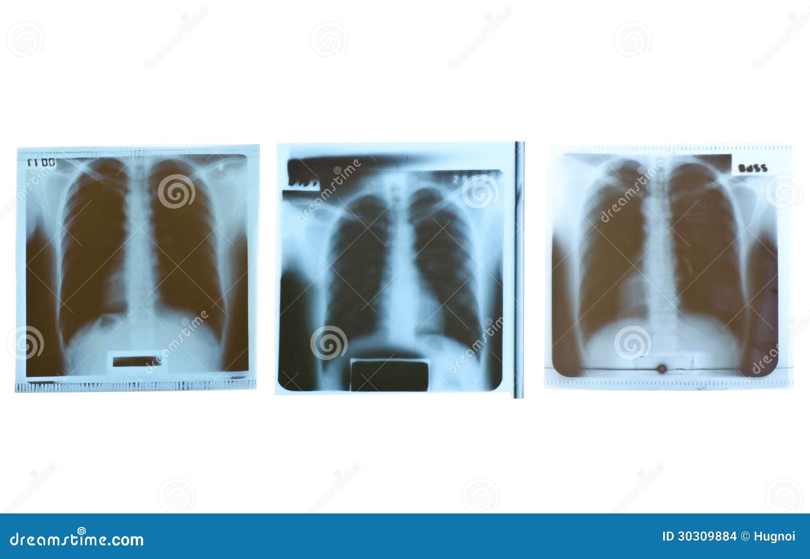Film x-ray stock photo. Image of film, inside, disease - 30309884
