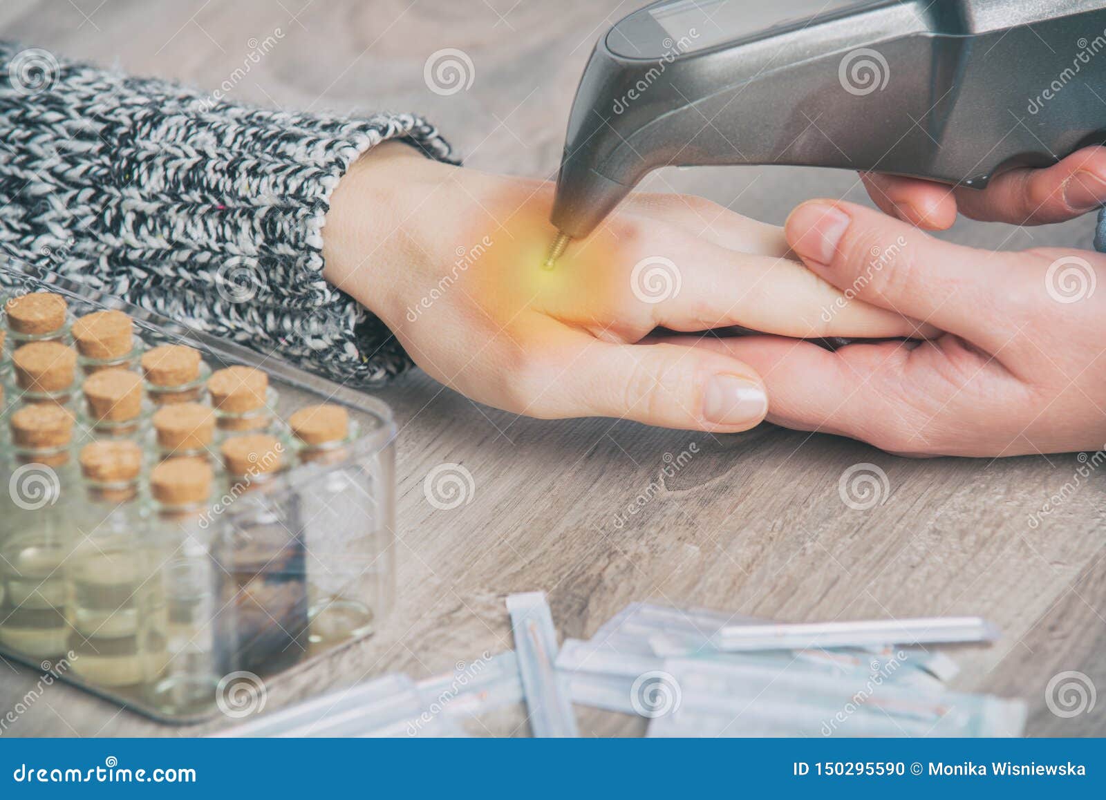 Therapist Finding an Acupuncture Point Stock Photo - Image of medical ...