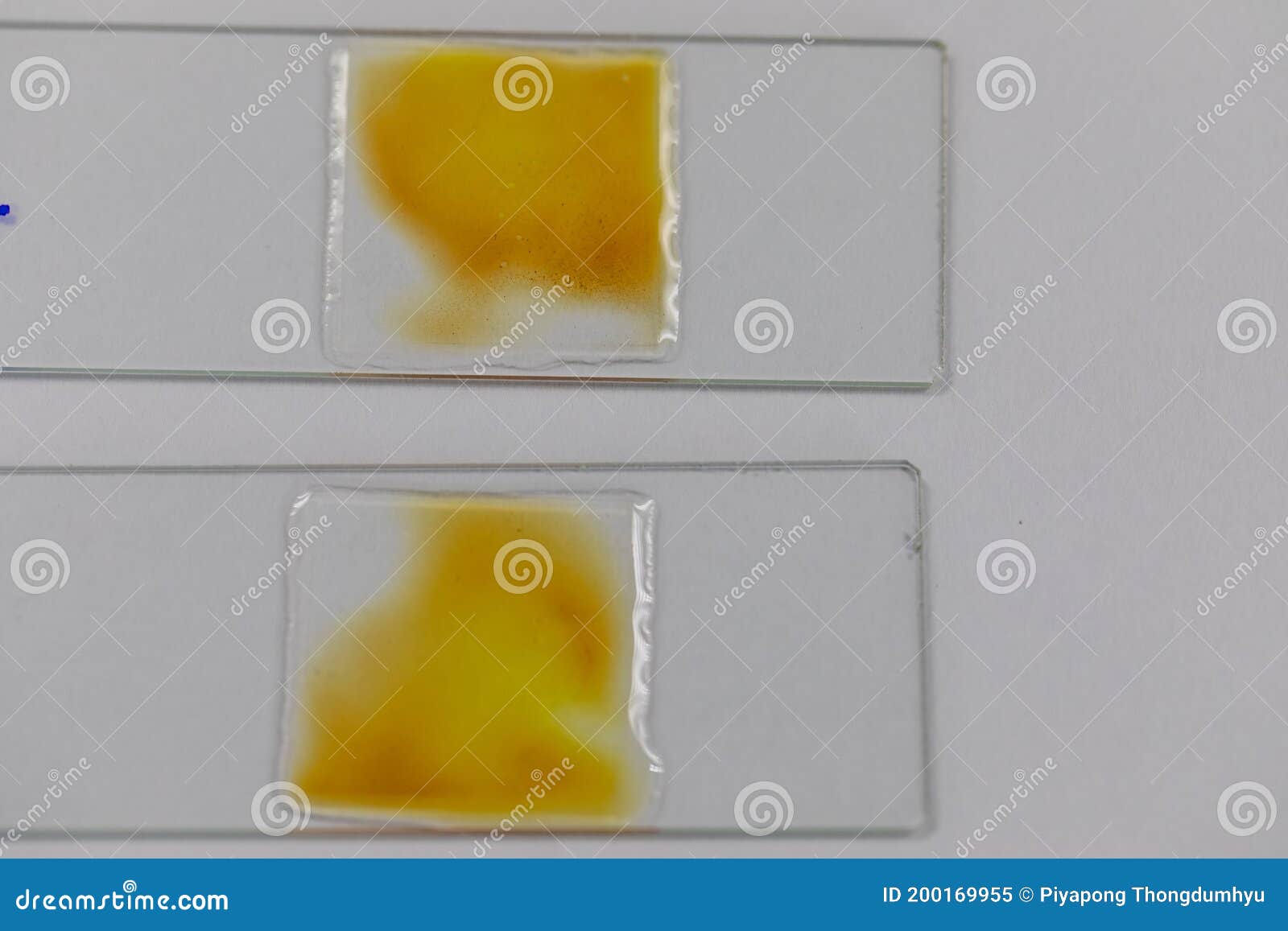 Finding Parasites in Feces. Stock Image - Image of helminth, identify ...