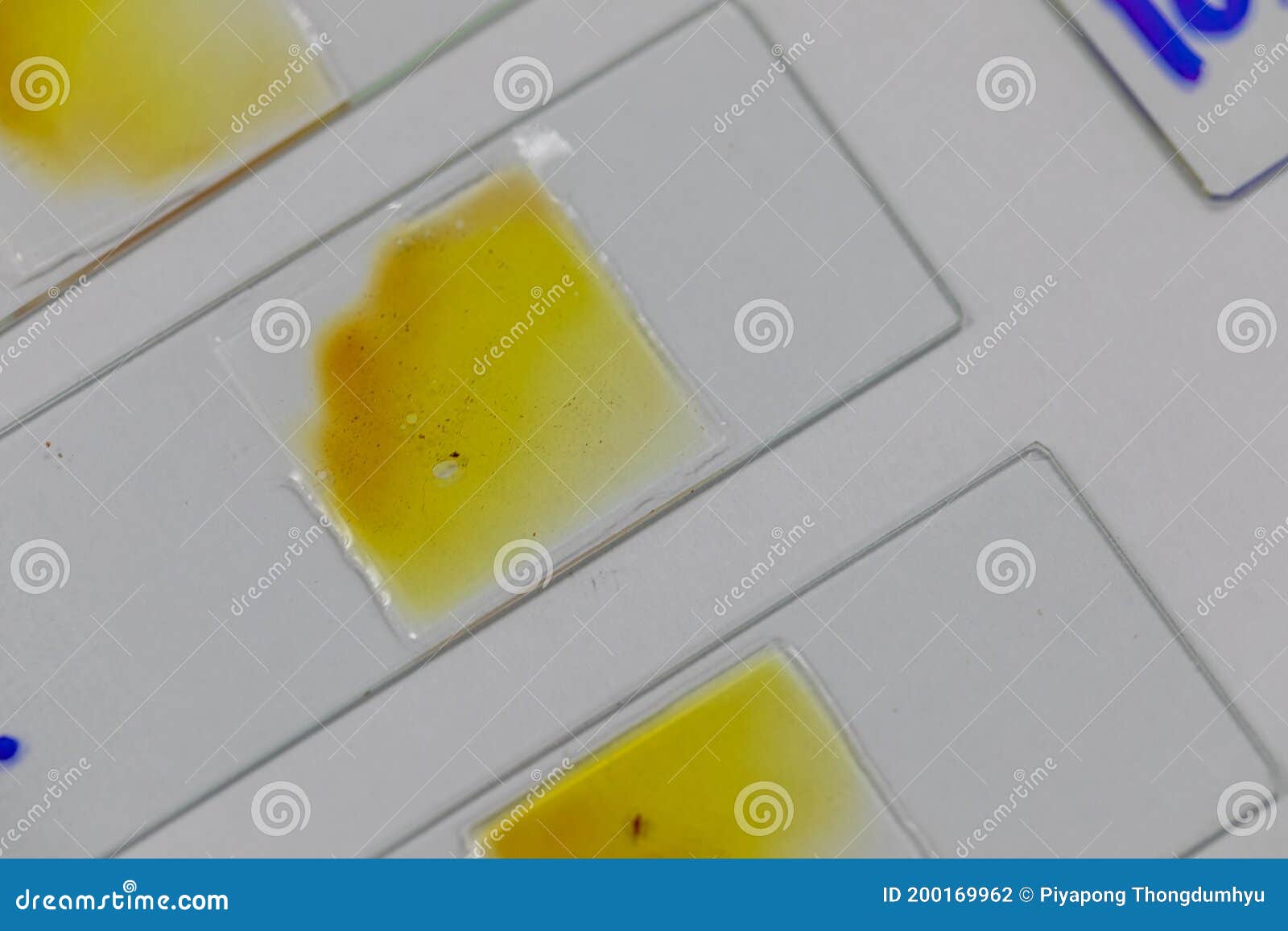 Finding Parasites in Feces. Stock Photo - Image of diagnose, helminth ...