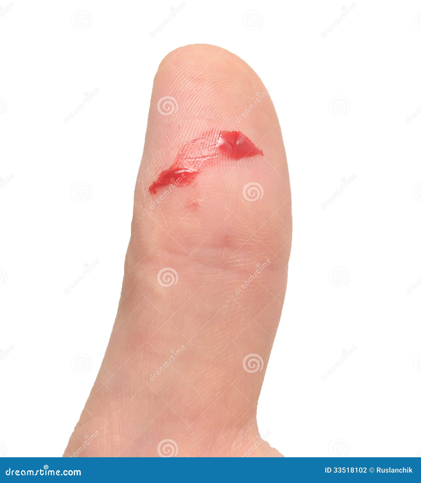 Finger with blood stock photo. Image of medical, human - 33518102