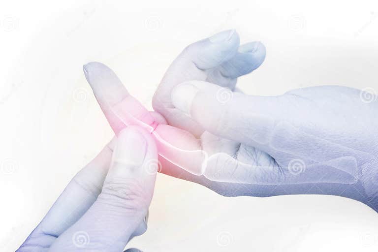 Finger bone pain stock image. Image of phalanges, osteoarthritis - 77637973