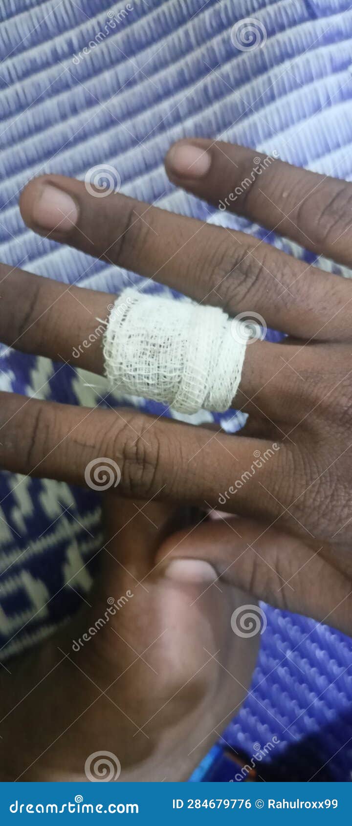 Finger Cut Boys Sad Moments Stock Photo - Image of boys, moments: 284679776