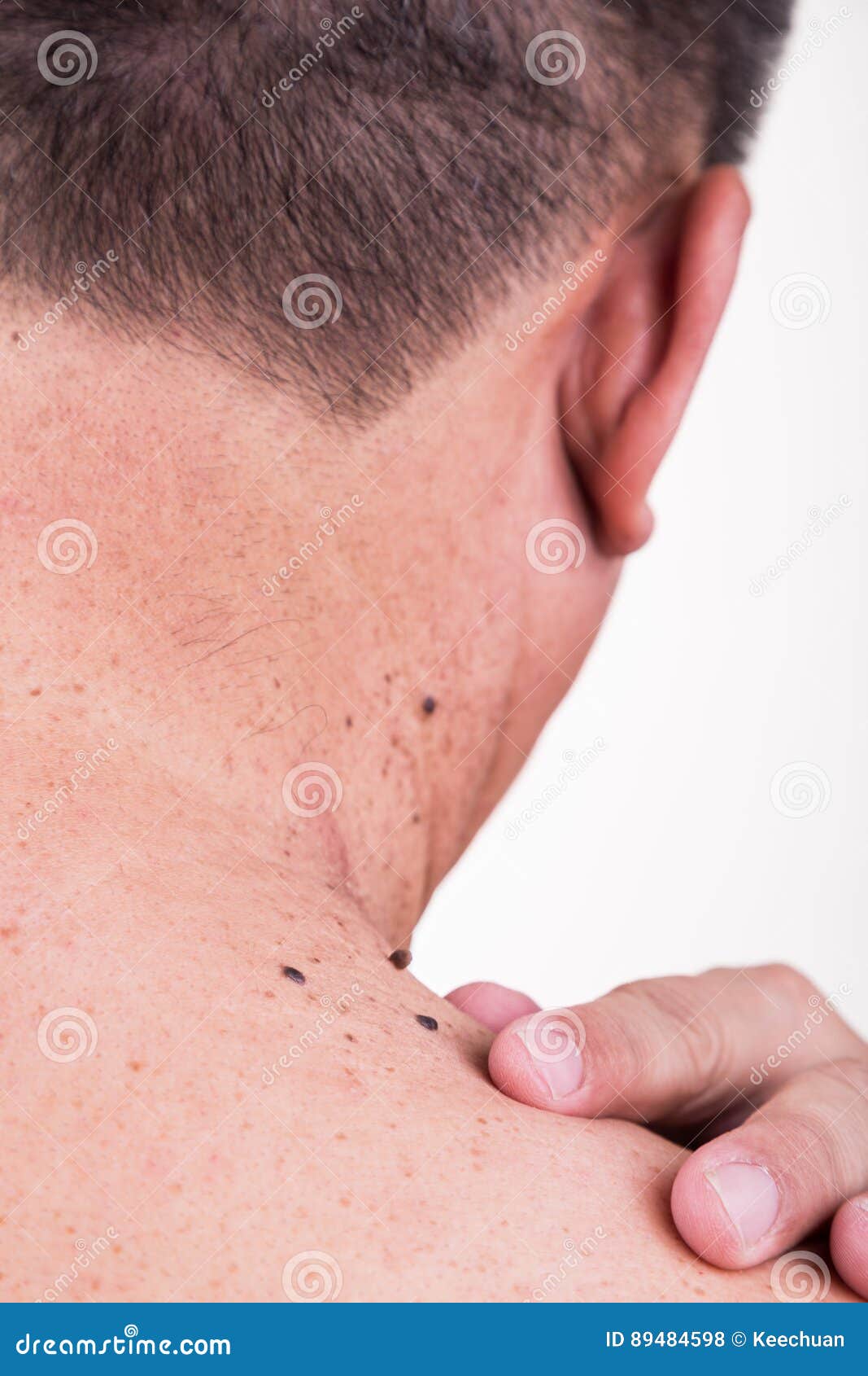 Finger Embrace Mole on Neck and Shoulder of Asian Male Stock Photo ...