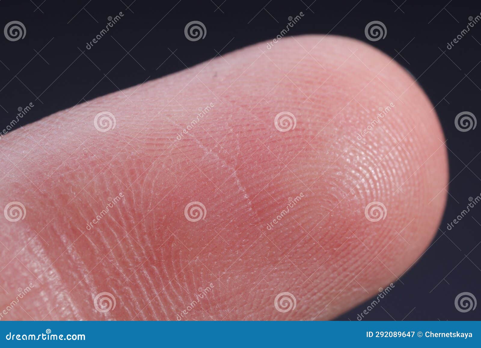 Finger with Friction Ridges on Dark Background, Macro View Stock Image ...
