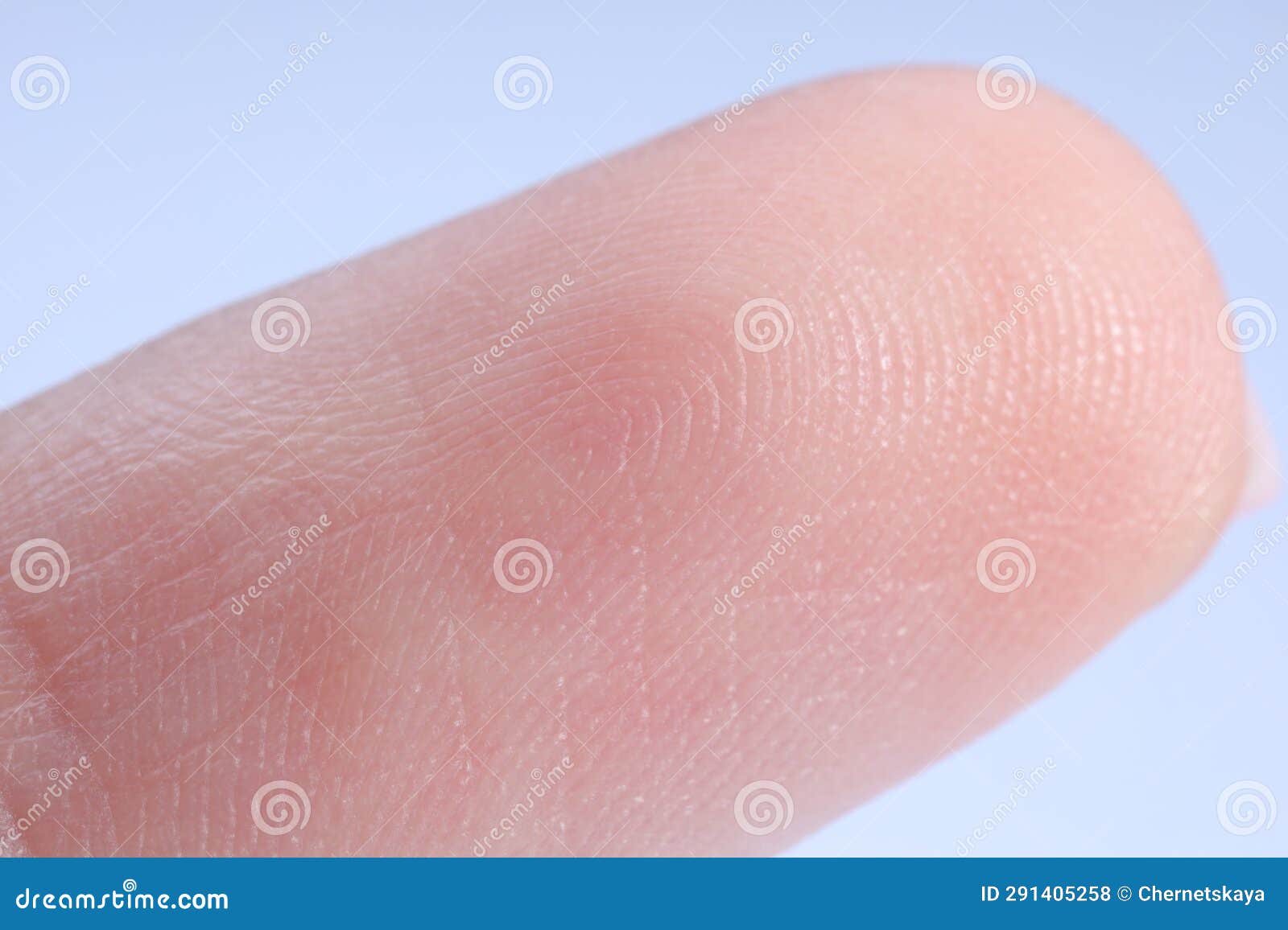 Finger with Friction Ridges on Light Blue Background, Macro View Stock ...