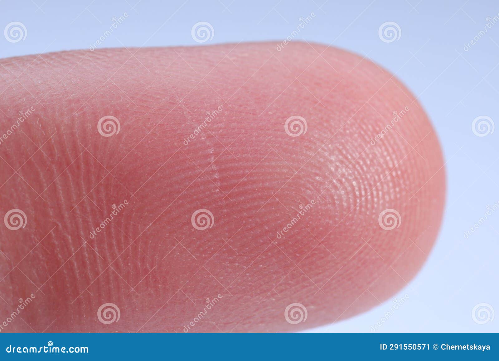 Finger with Friction Ridges on Light Blue Background, Macro View Stock ...