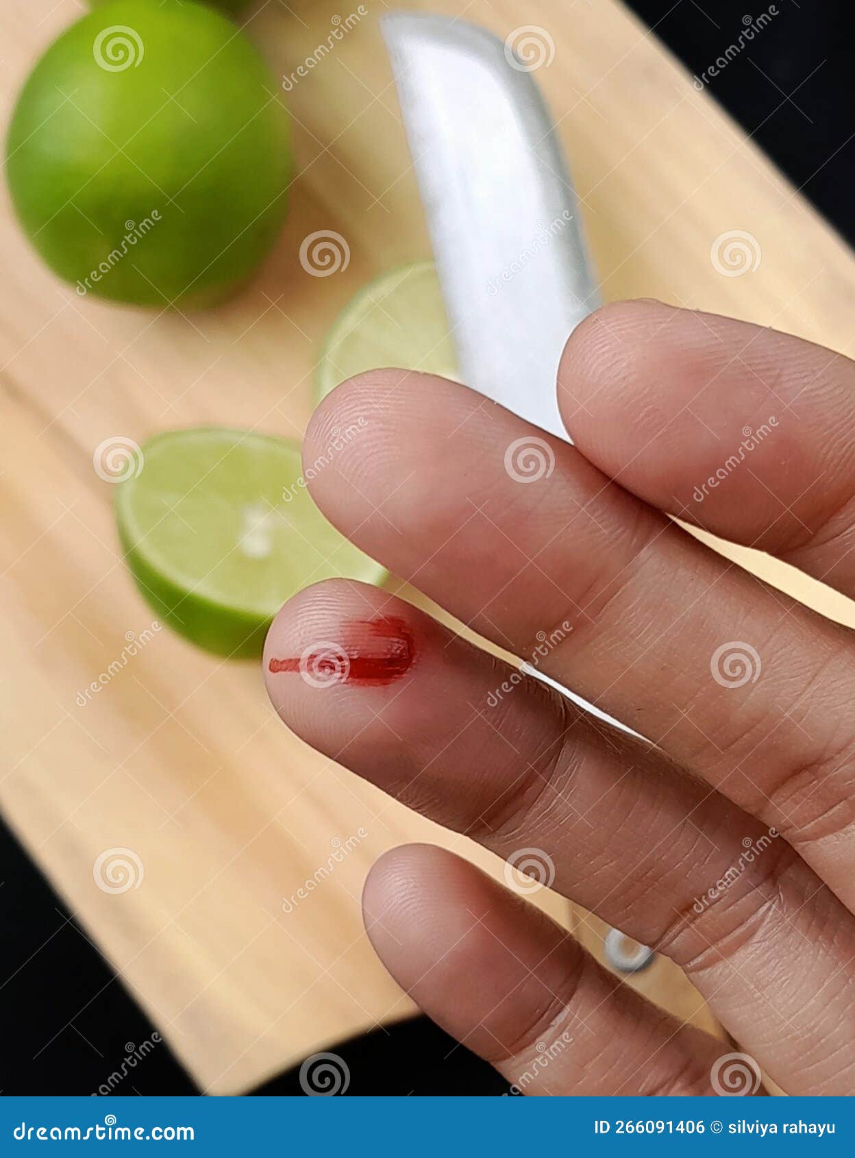 Finger Injuries from Knife Scratches Stock Photo - Image of scar ...