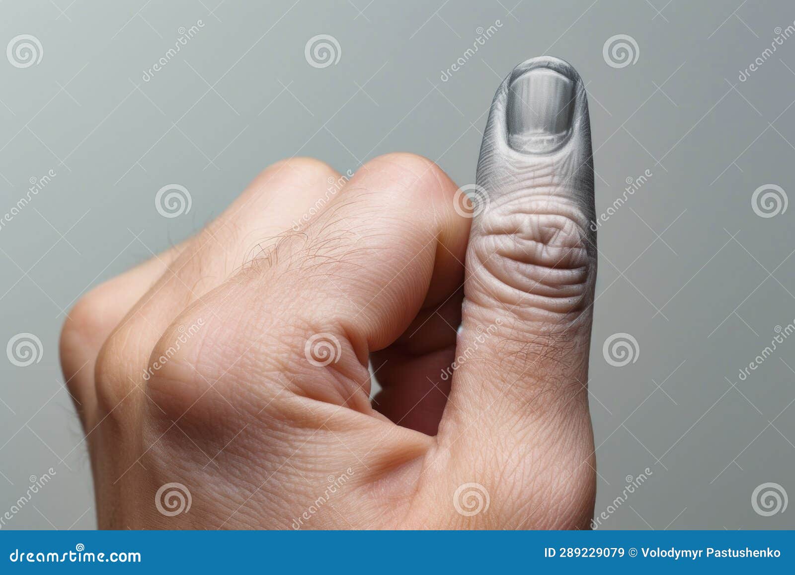 Finger with Finger Ring on it& X27;s Thumb. Generative AI Stock ...