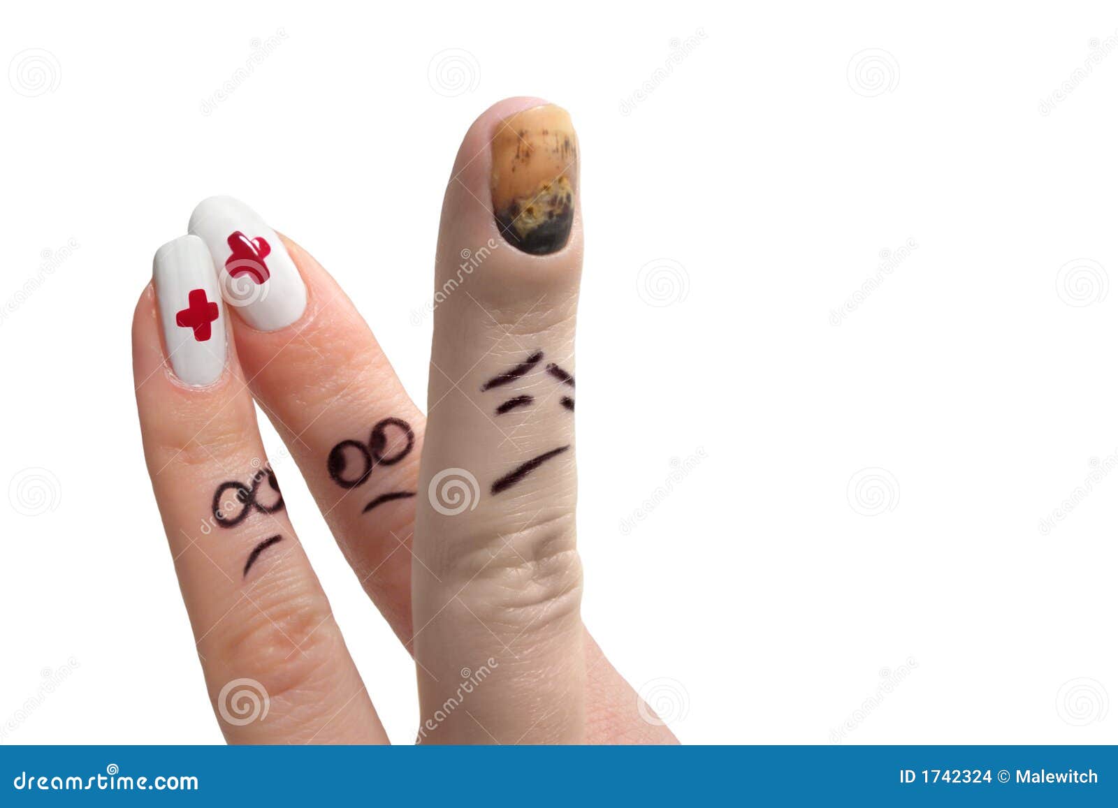 Finger show-2 editorial stock image. Image of medical - 1742324