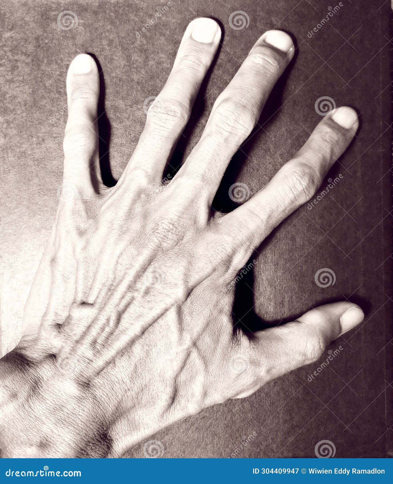 Finger tendon stock image. Image of tendon, prominently - 304409947