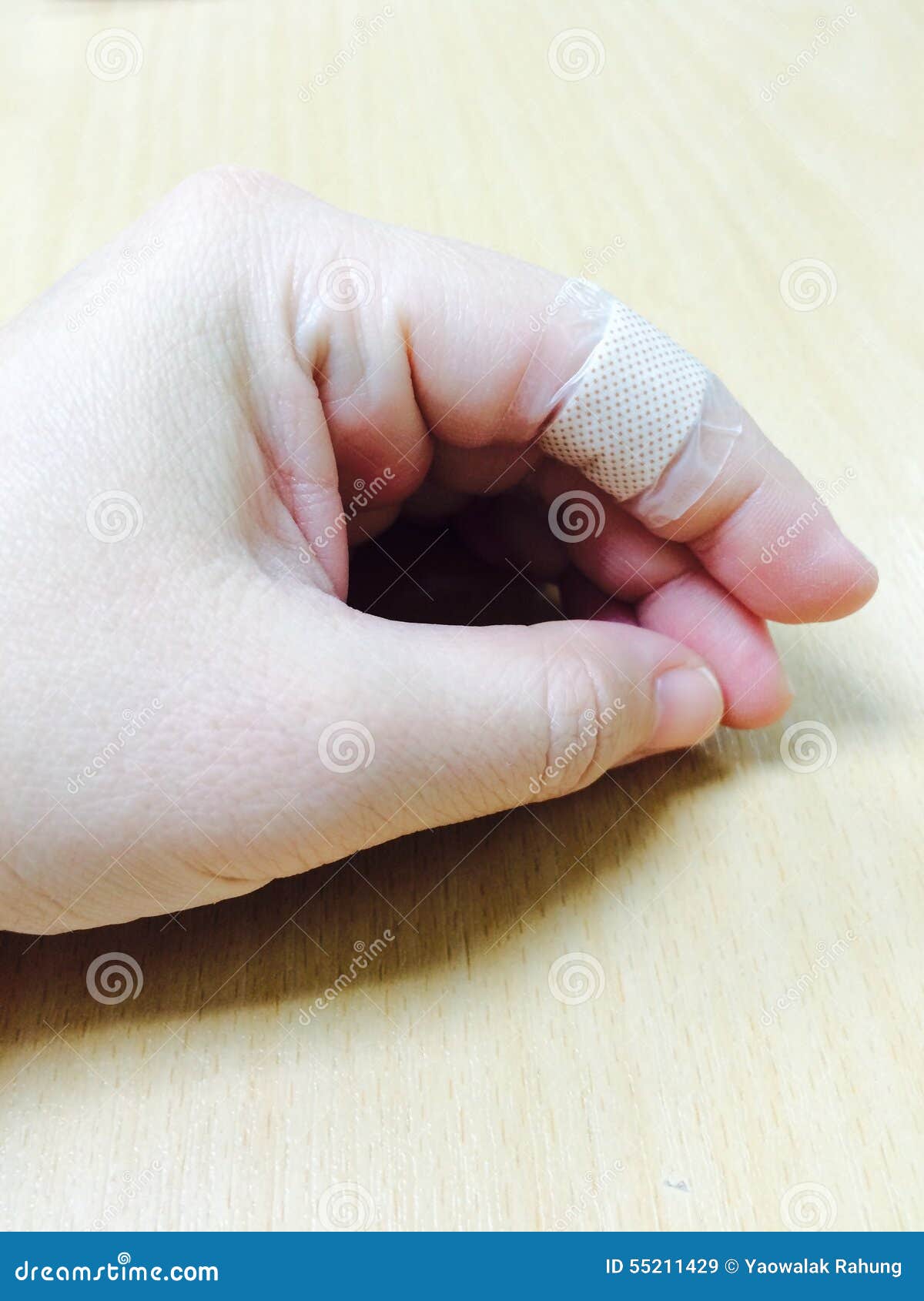 Finger Ulcers Royalty-Free Stock Image | CartoonDealer.com #55211416
