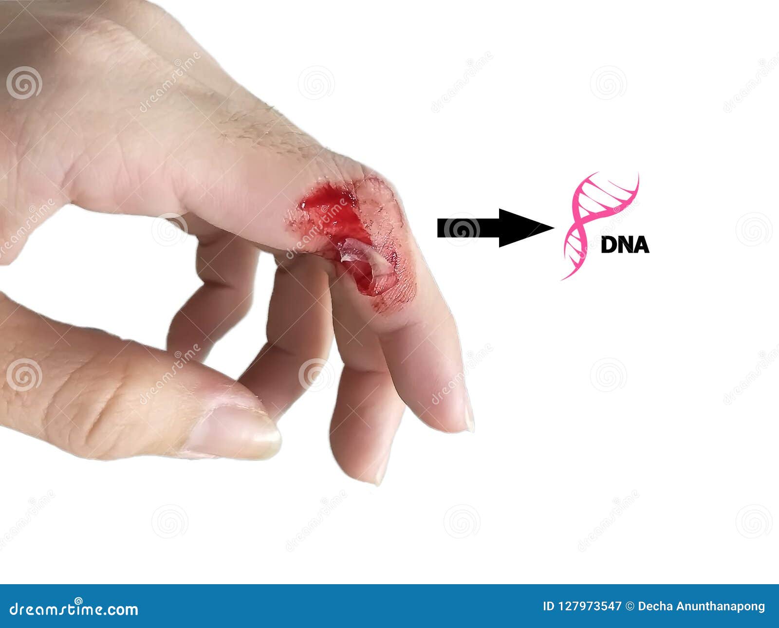 Finger is wound stock image. Image of skin, finger, medical - 127973547
