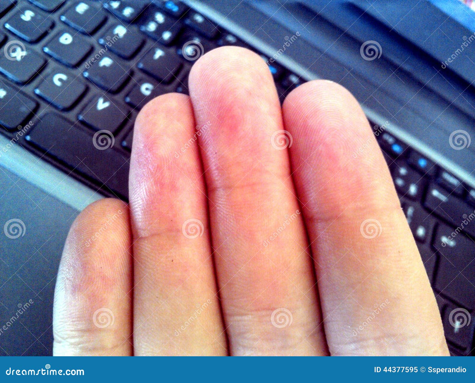 Fingers Above the Notebook Keyboard Stock Image - Image of computer ...